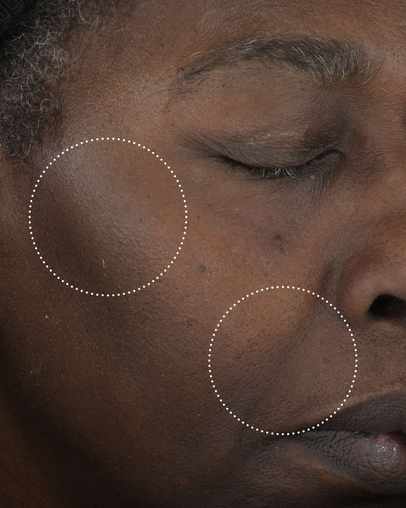 Triple Lipid-Peptide Cream | Skinfix – Skinfix CA